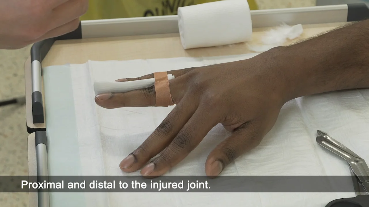 Finger Buddy Strapping