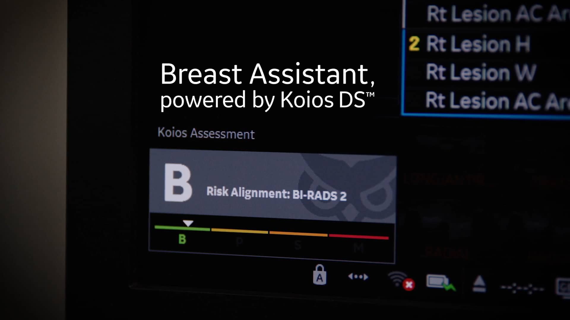 GE Healthcare's Breast Assistant, Powered by Koios DS on Vimeo