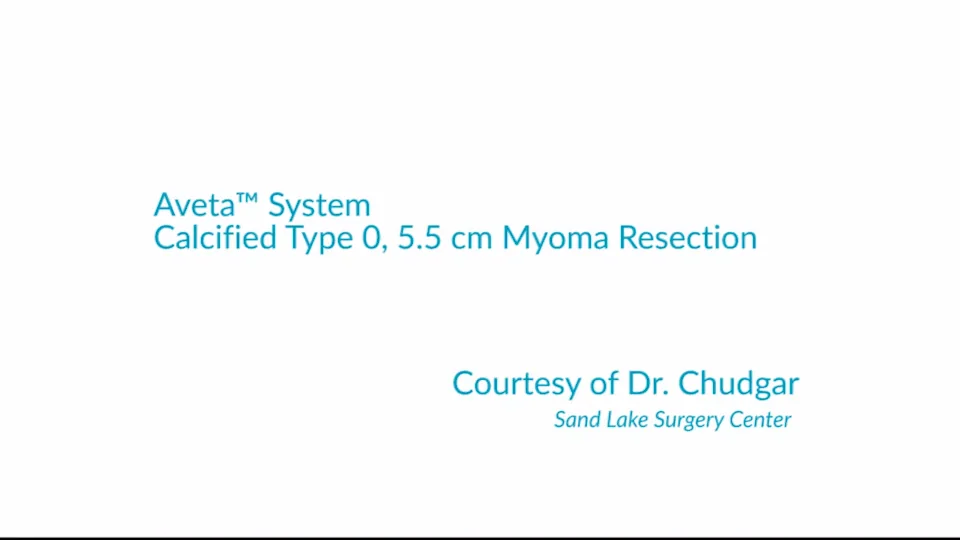 Dr. Chudgar Aveta™ System Calcified Type 0 5.5cm Myoma Resection