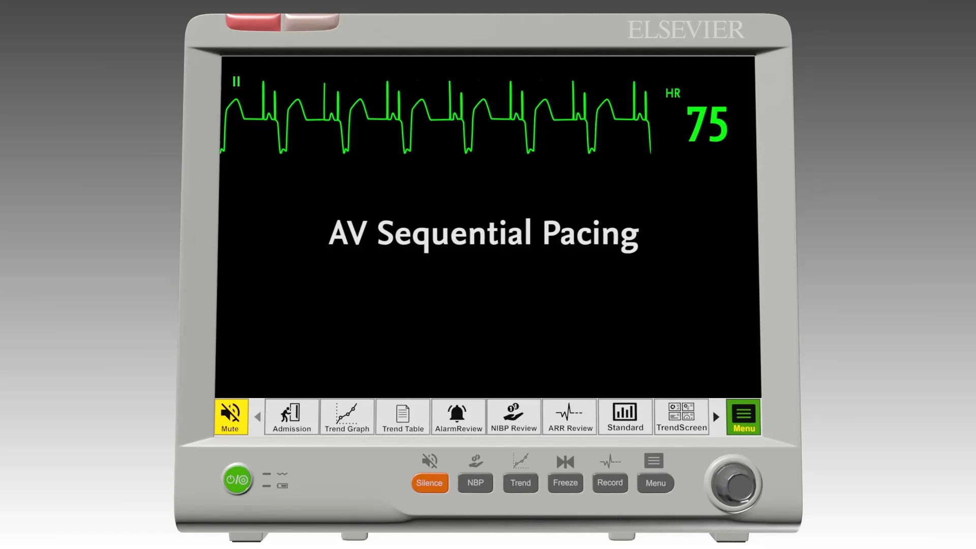 ECG Monitors - AV Sequential Pacing on Vimeo