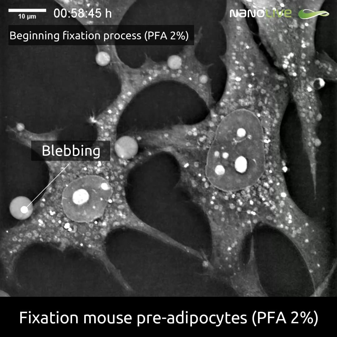 PFA (2%) fixation test: the effects on live cell imaging on Vimeo