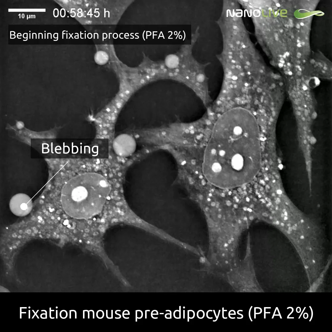 PFA (2%) fixation test: the effects on live cell imaging on Vimeo