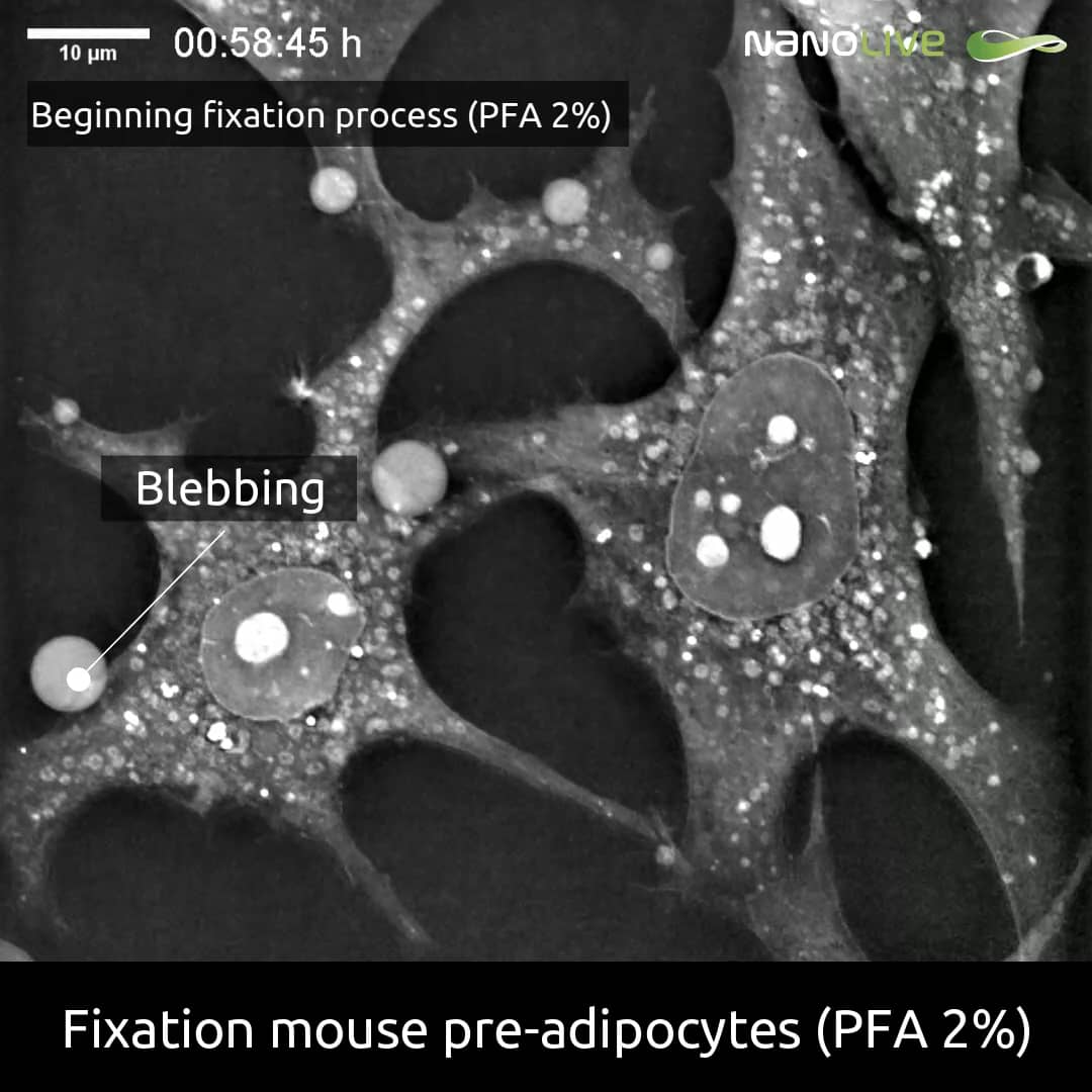 PFA (2%) fixation test: the effects on live cell imaging on Vimeo
