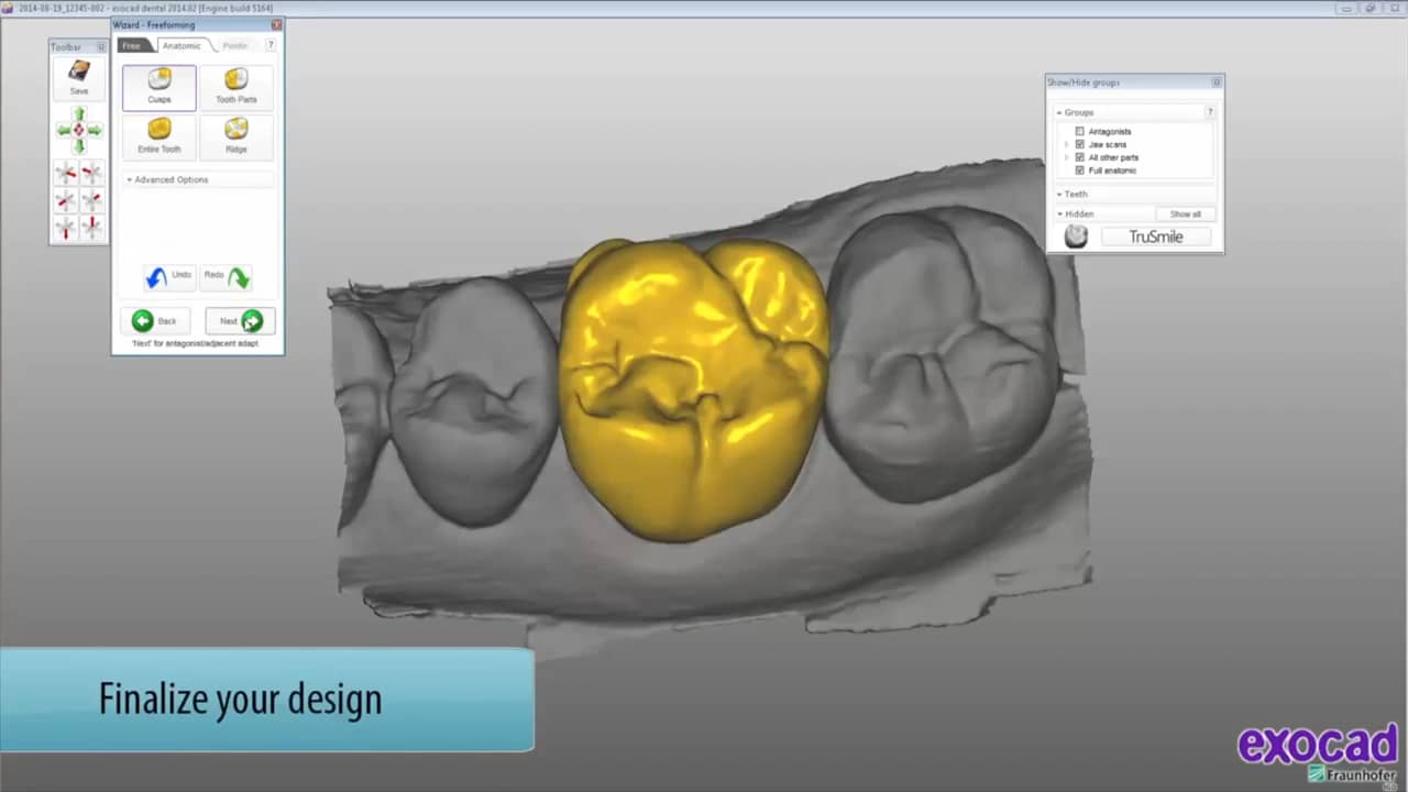 Importing STL into Exocad on Vimeo