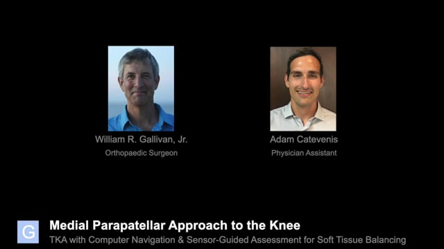 TKA with Computer Navigation & Sensor-Guided Assessment for Soft Tissue ...