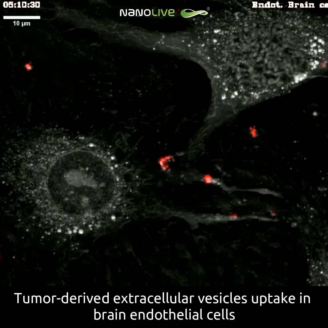 Tumor-derived extracellular vesicles uptake in mouse brain endothelial ...