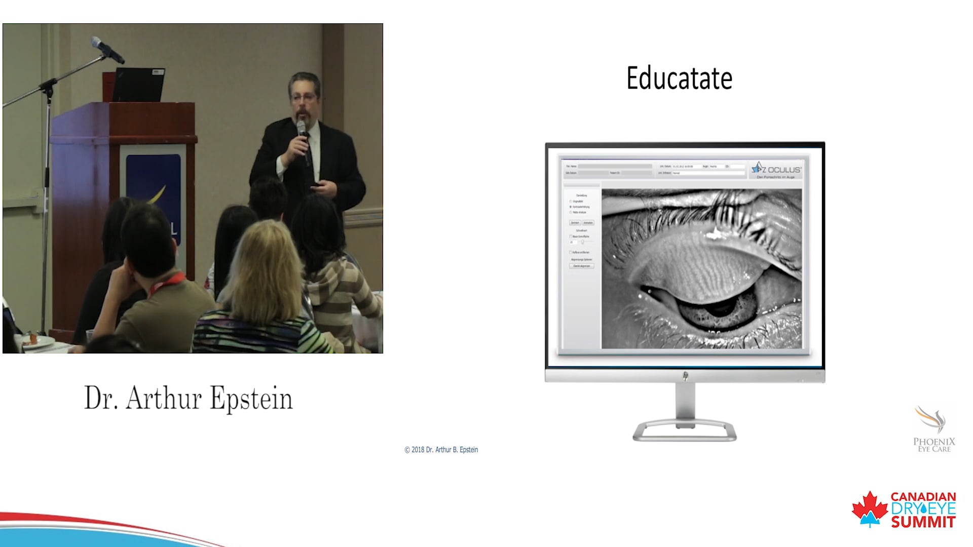 Dr Arthur Epstein: The Zen of Dry Eye mastery on Vimeo