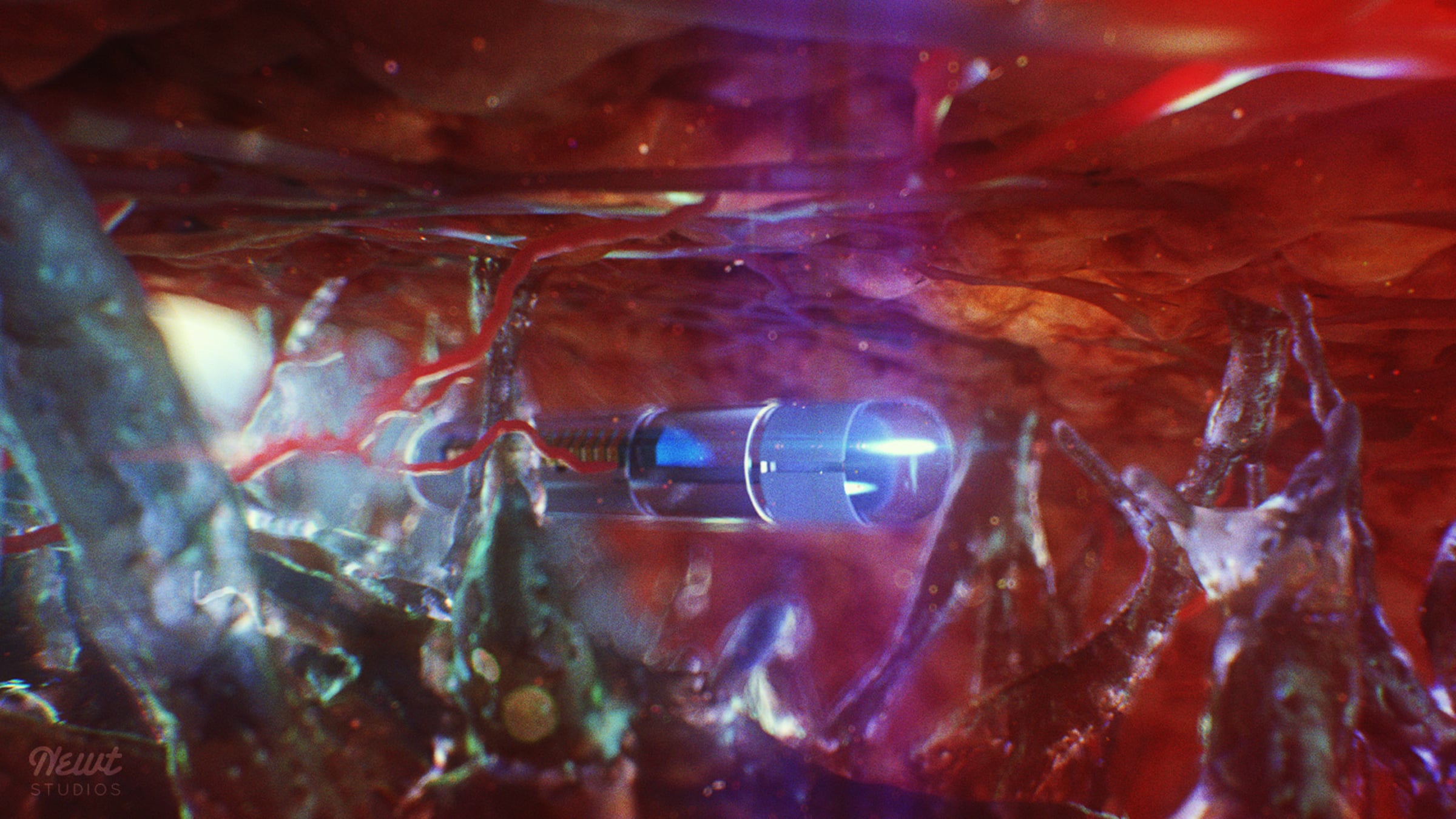 Eversense - Subcutaneous Glucose Sensor MOA