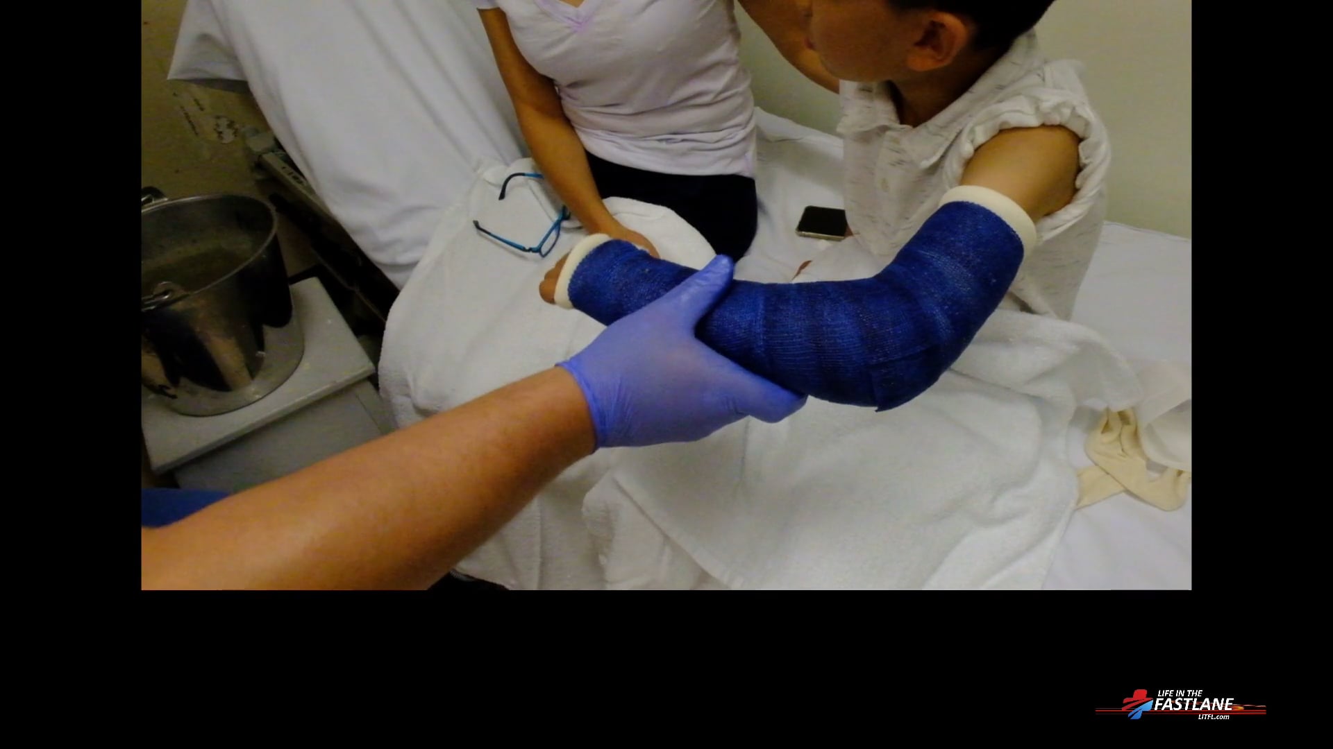 Above elbow fibreglass on Vimeo