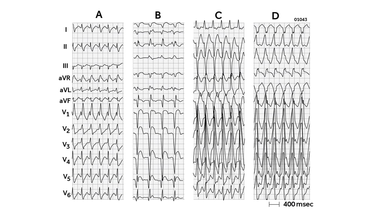 Monday Lecture - ECG 23_9 on Vimeo