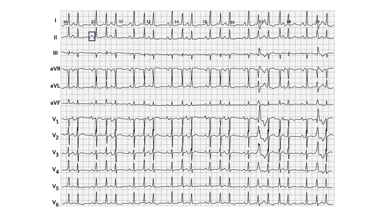 Monday Lecture - ECG 30_2 on Vimeo