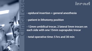 Total laparoscopic Hudson’s procedure, pelvic and para-aortic node ...