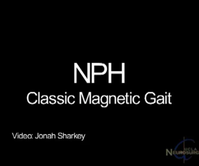 NPH Gait, pre-surgery