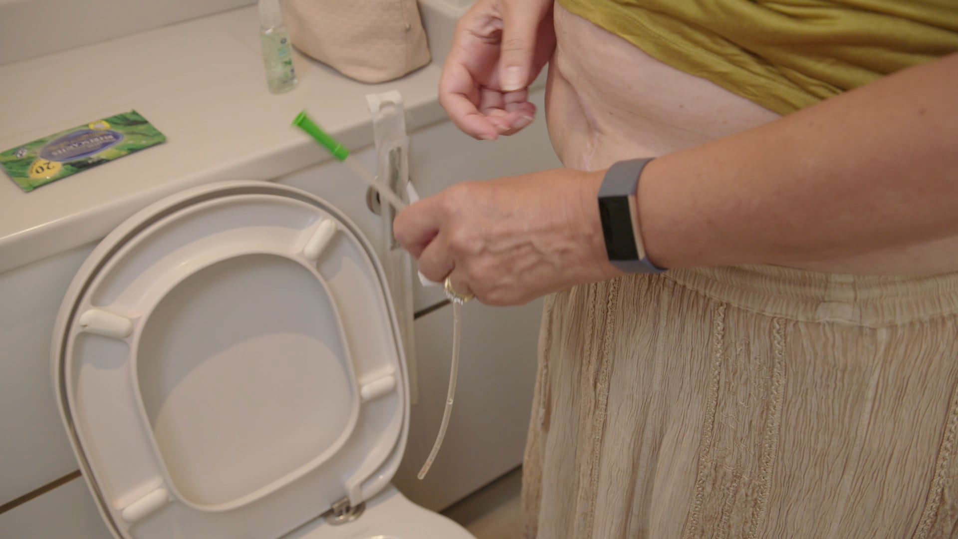 Catheterising a Mitrofanoff on Vimeo