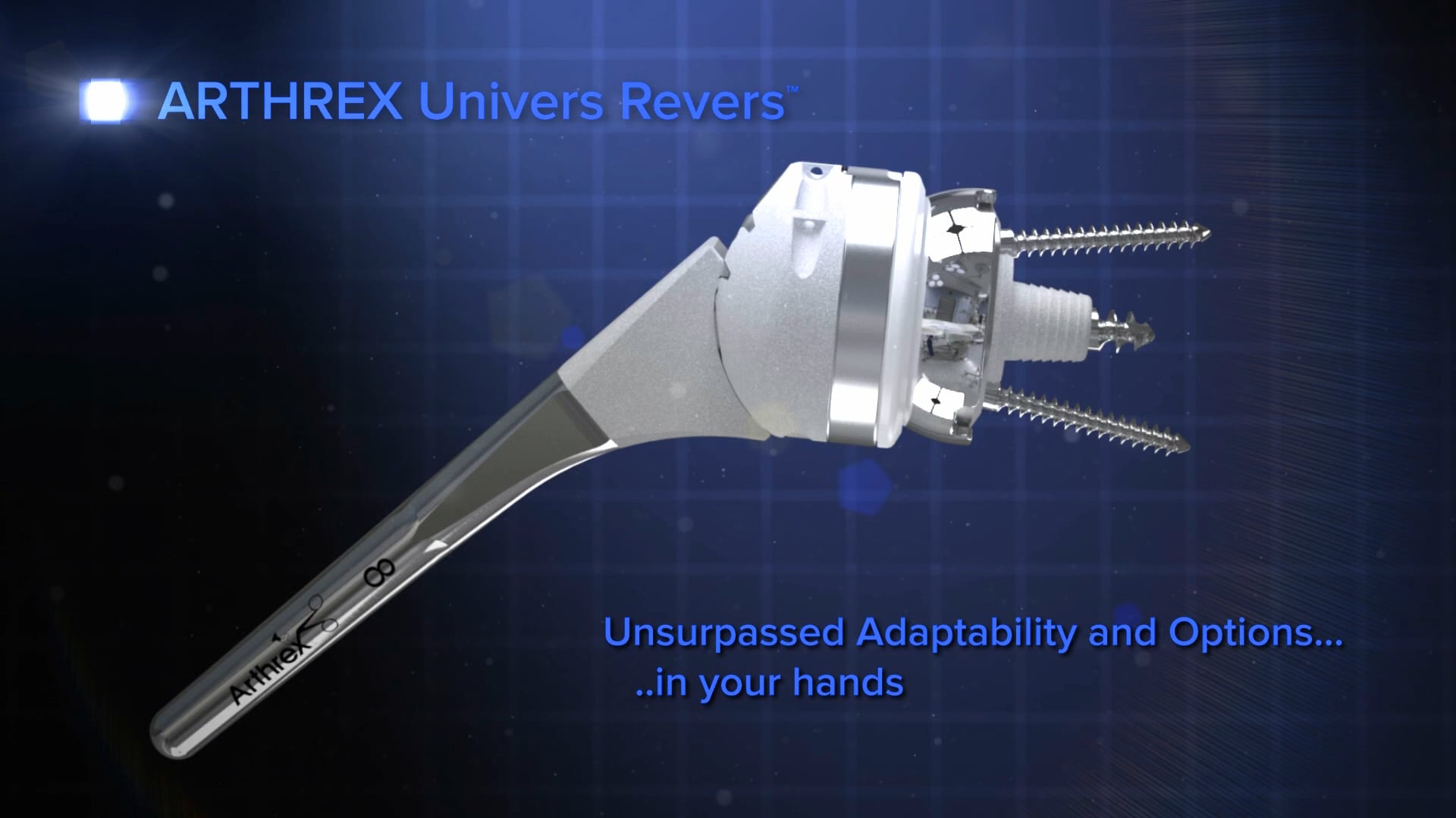 Arthrex Univers Revers™ on Vimeo