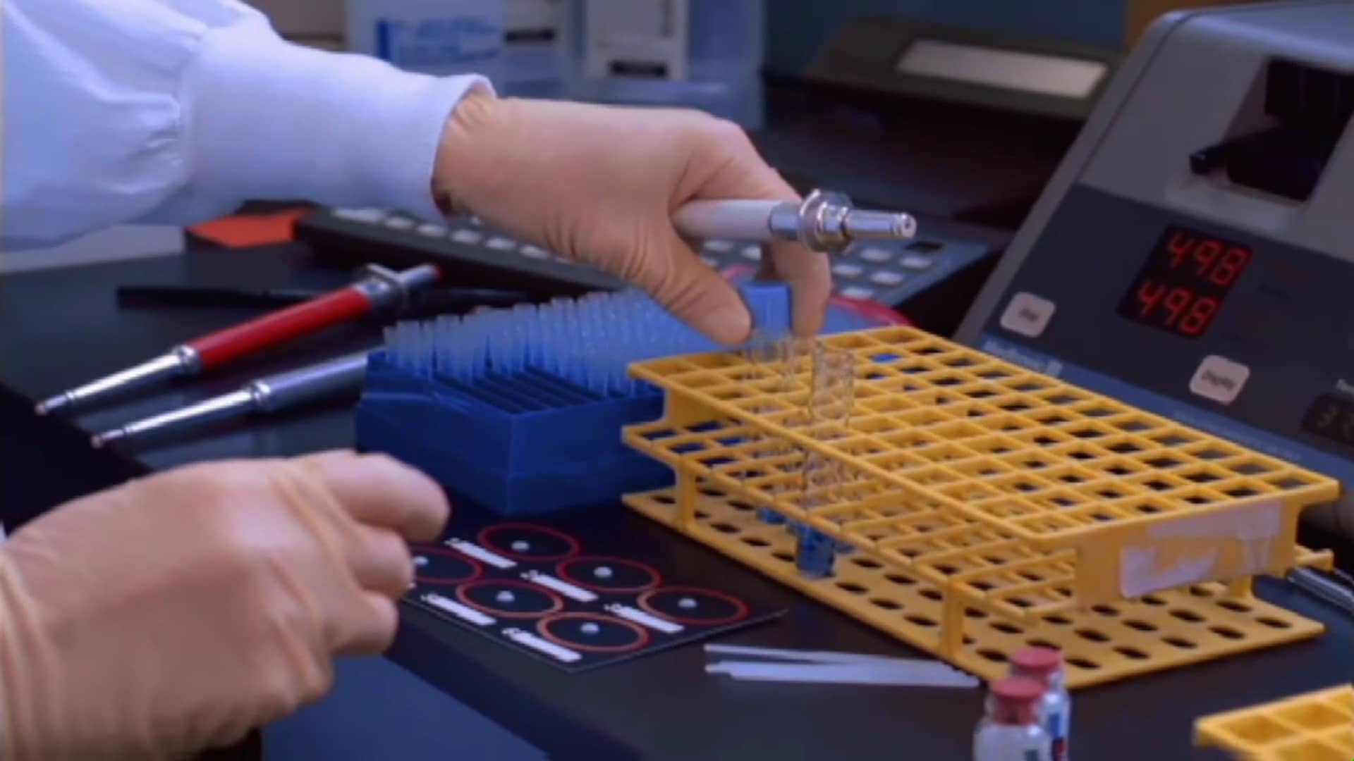 Ferinject Administration Intravenous Injection on Vimeo