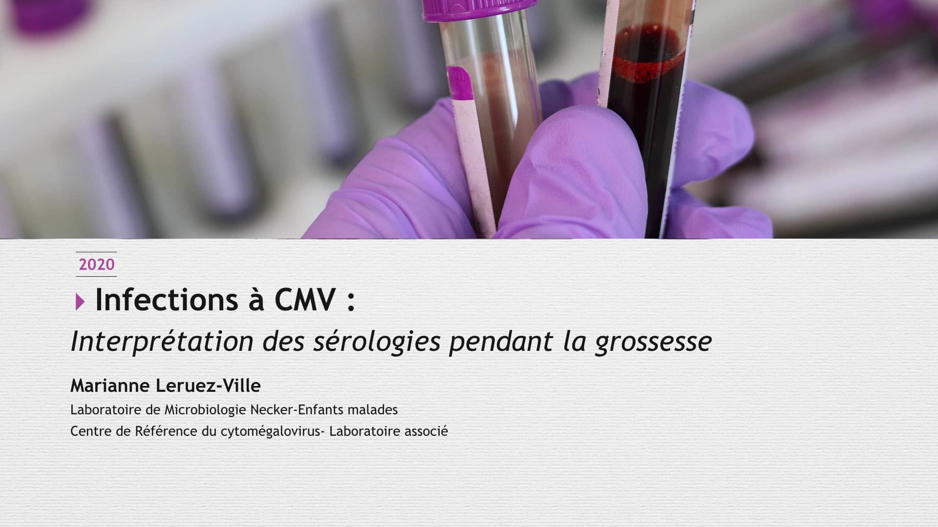 Interprétation des sérologies CMV pendant la grossesse on Vimeo