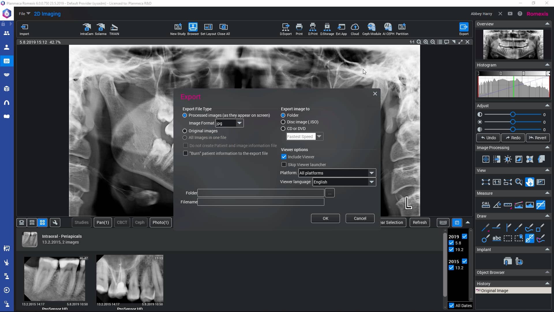 How to - Export 2D image from Planmeca Romexis on Vimeo