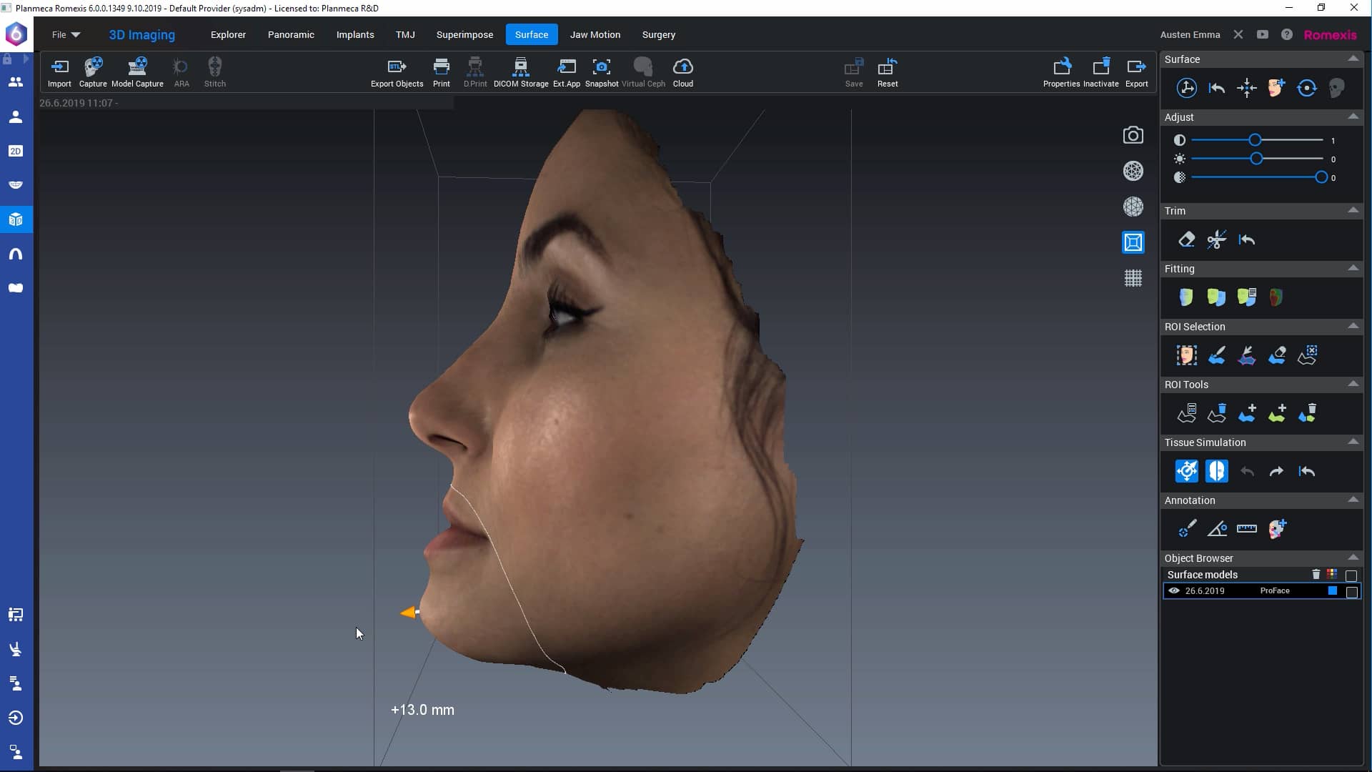 How to adjust 3D photo (ProFace) in Planmeca Romexis on Vimeo