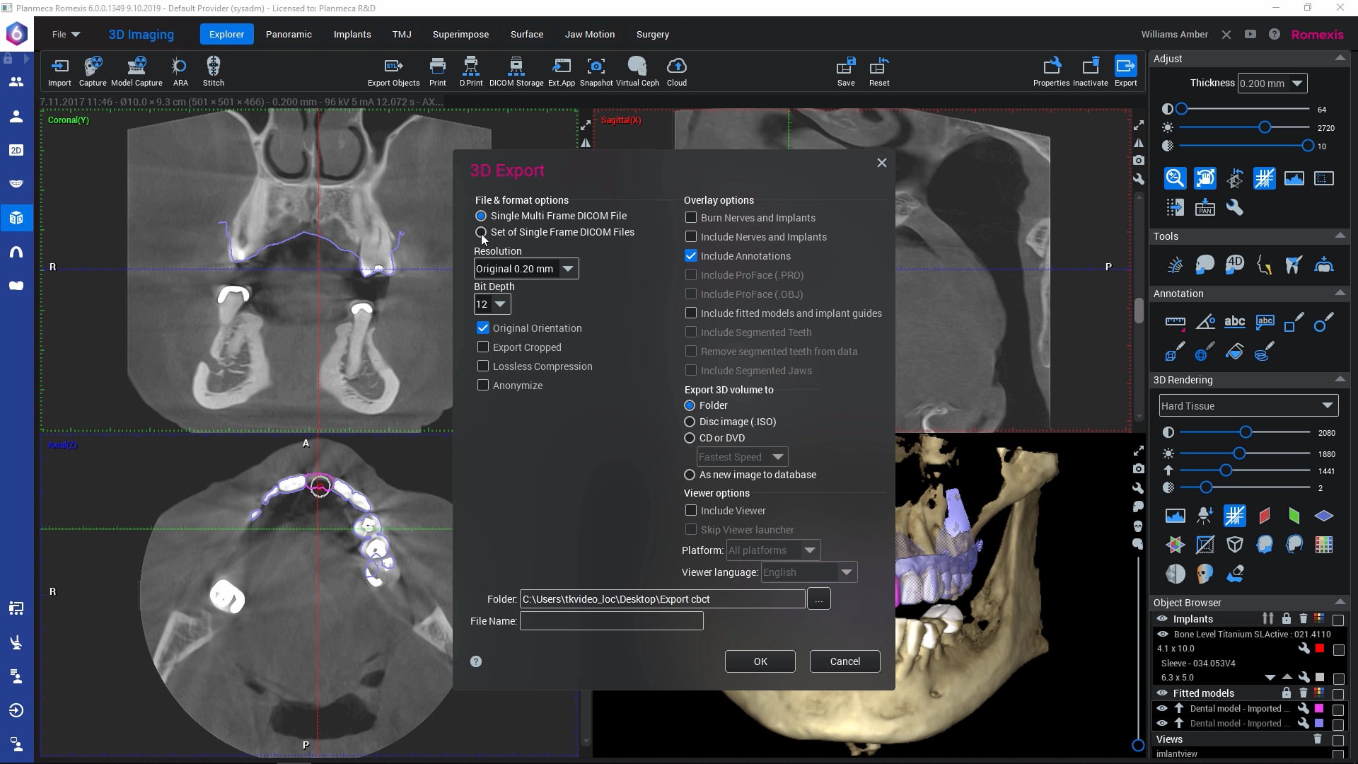 How to - Export CBCT image in DICOM format from Planmeca Romexis on Vimeo