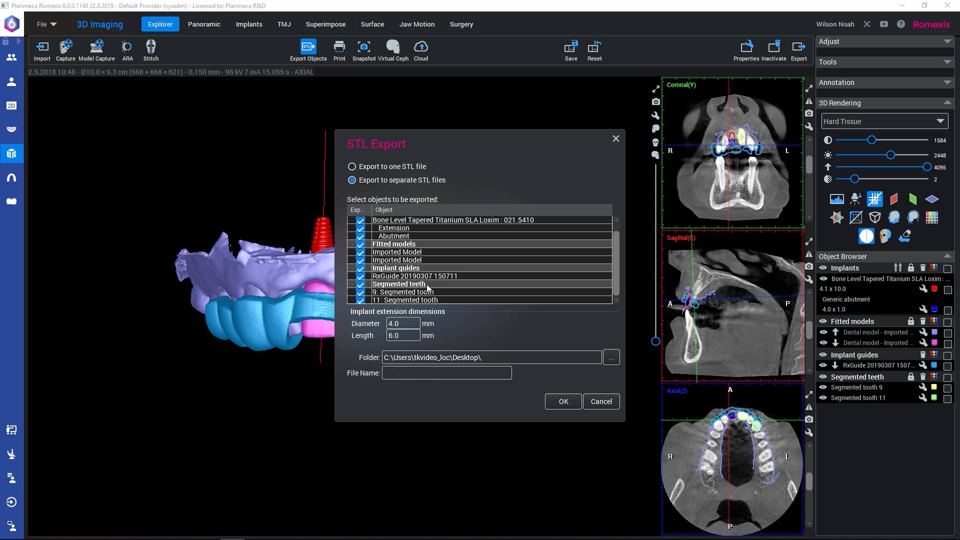 How to - Export STL objects from Planmeca Romexis on Vimeo