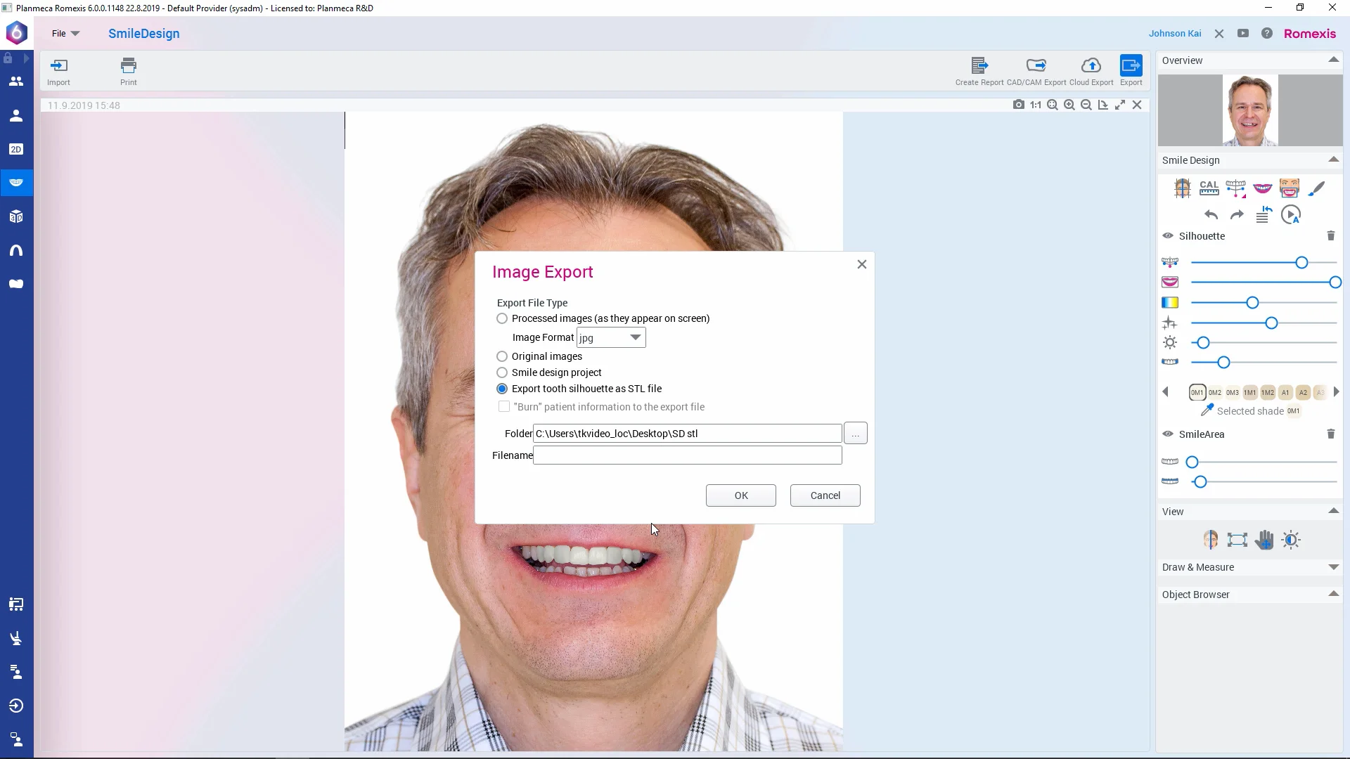 How to - Export Smile design silhouette in STL format from Planmeca ...