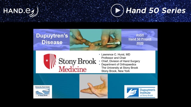 Dupuytren Disease: HERO | For Residents | Hand.e - ASSH