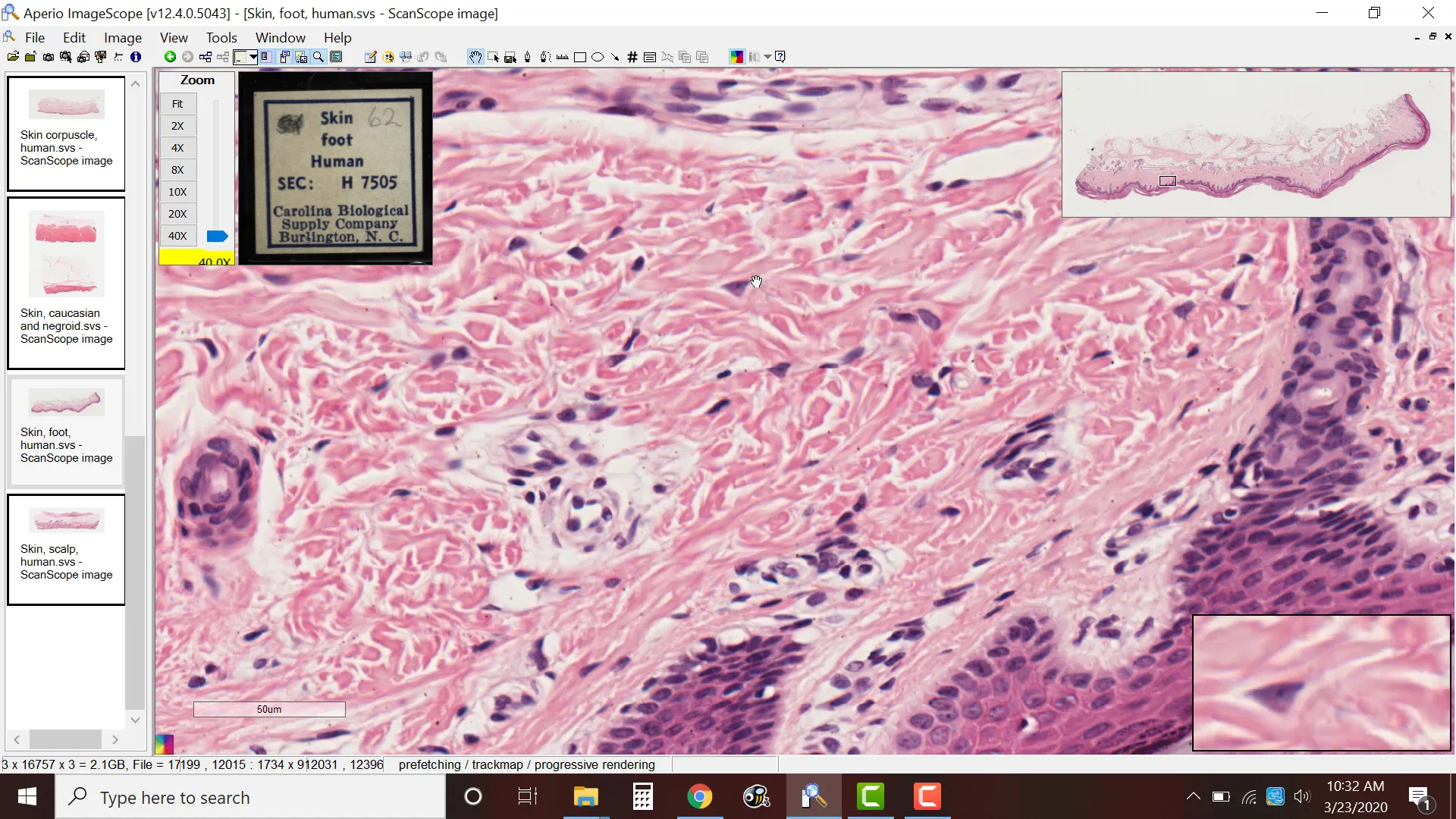 INTEGUMENT DIGITAL SLIDES