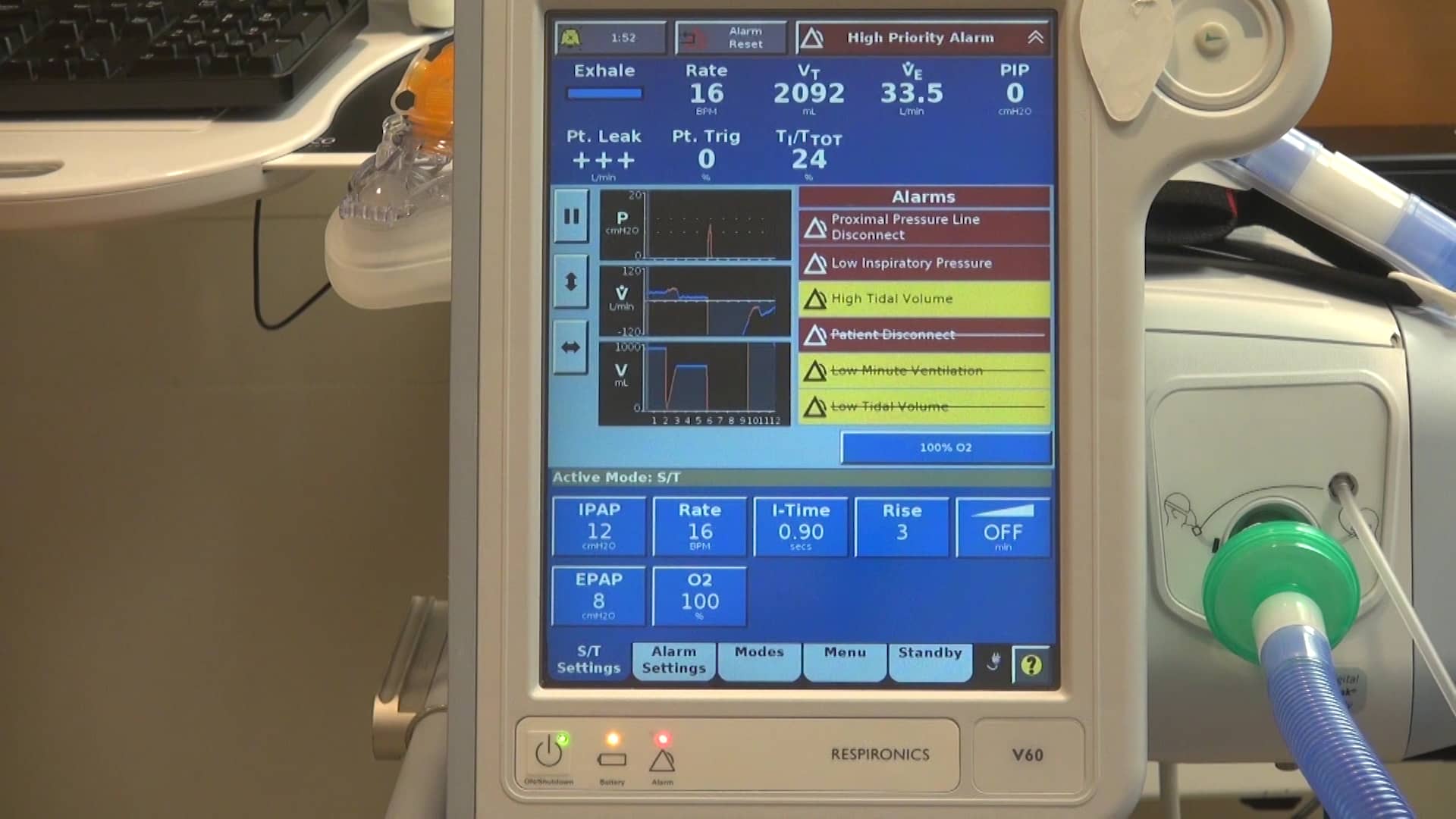 Clinical Education - BiPAP Demonstration on Vimeo