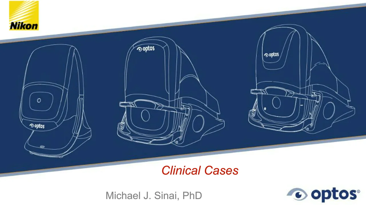 Webinar - Optos OCT Case Review