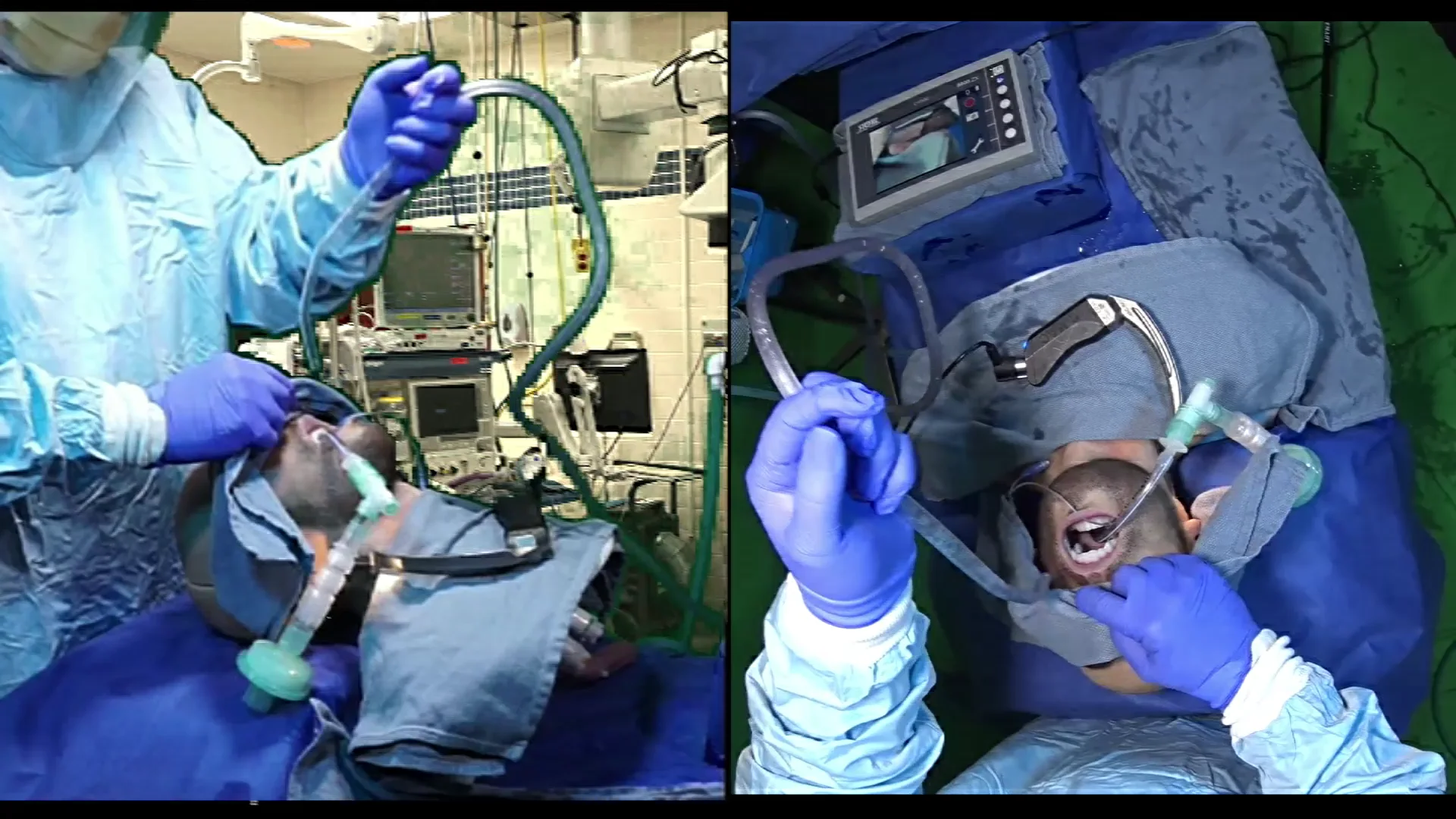 SALAD with face drape approach to COVID-19 Intubation on Vimeo