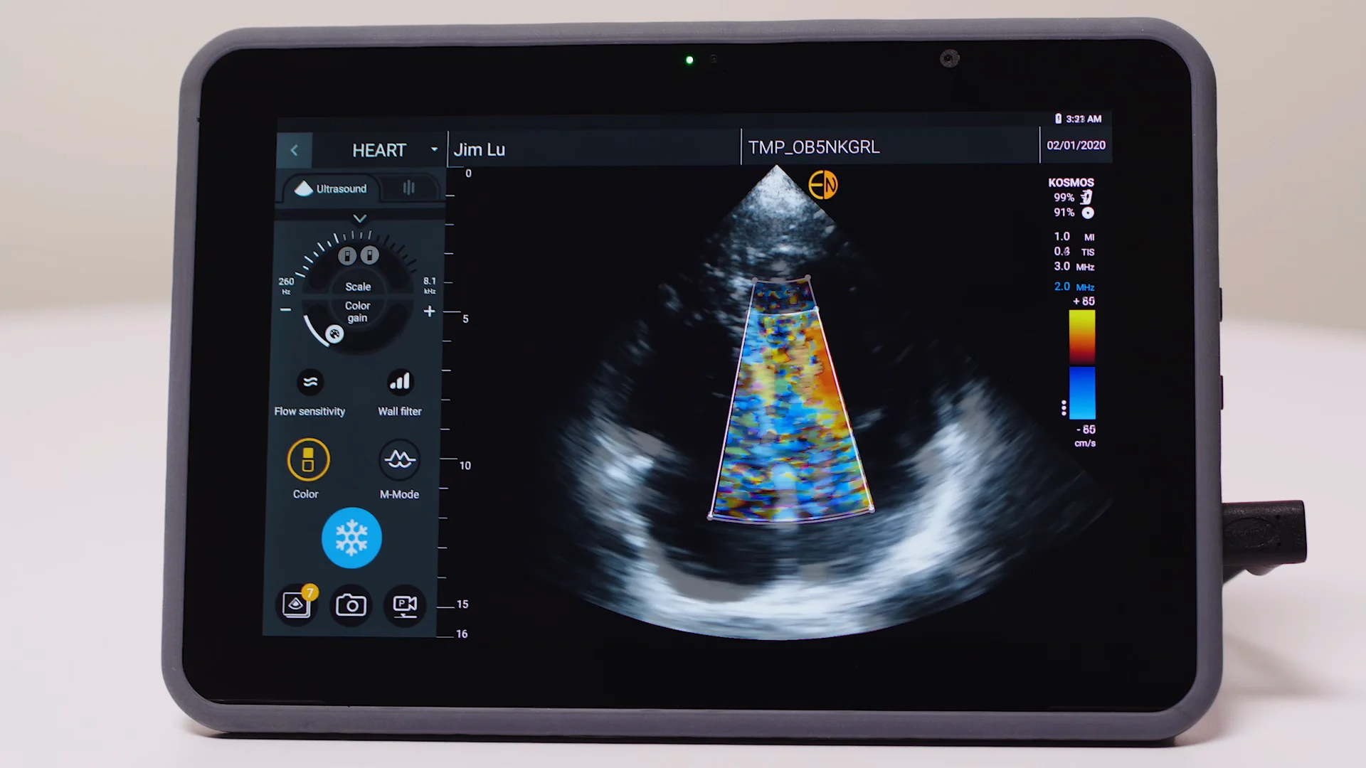 Kosmos Torso™ Fargedoppler on Vimeo