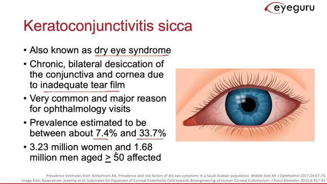 Keratoconjunctivitis Sicca