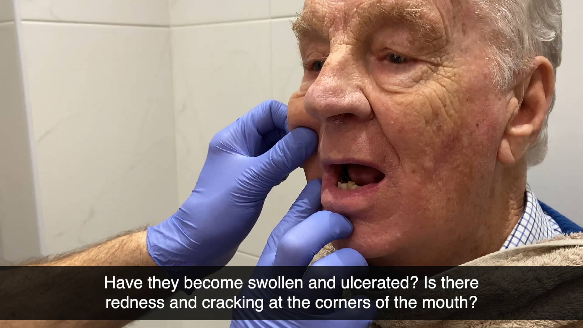 Examining someone else's mouth on Vimeo