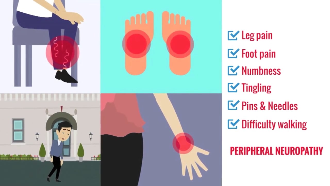 MATRIX System by NeuroMed