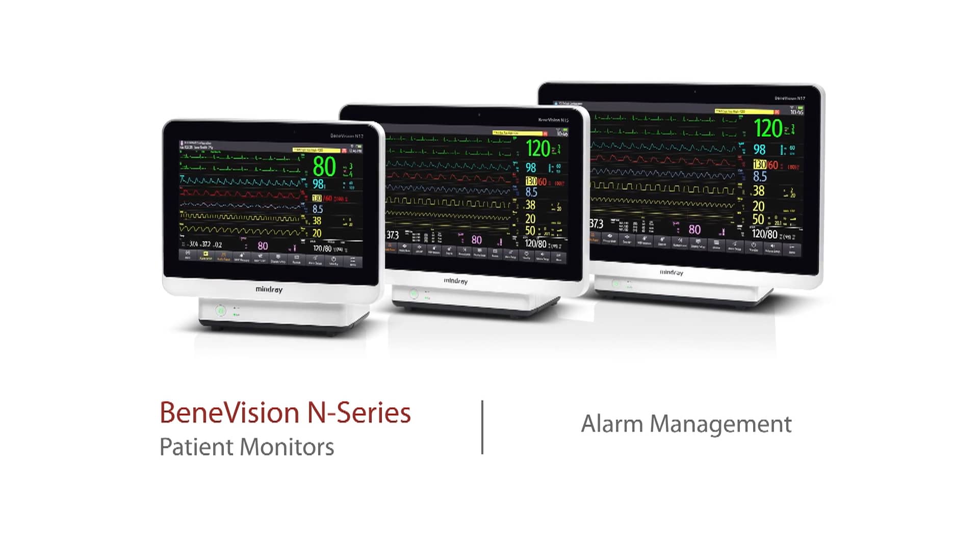 Mindray N-Series User Training - Part 4 - Alarm Management on Vimeo