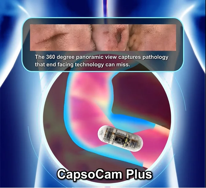 360 View Animation Video - CapsoCam for Website on Vimeo