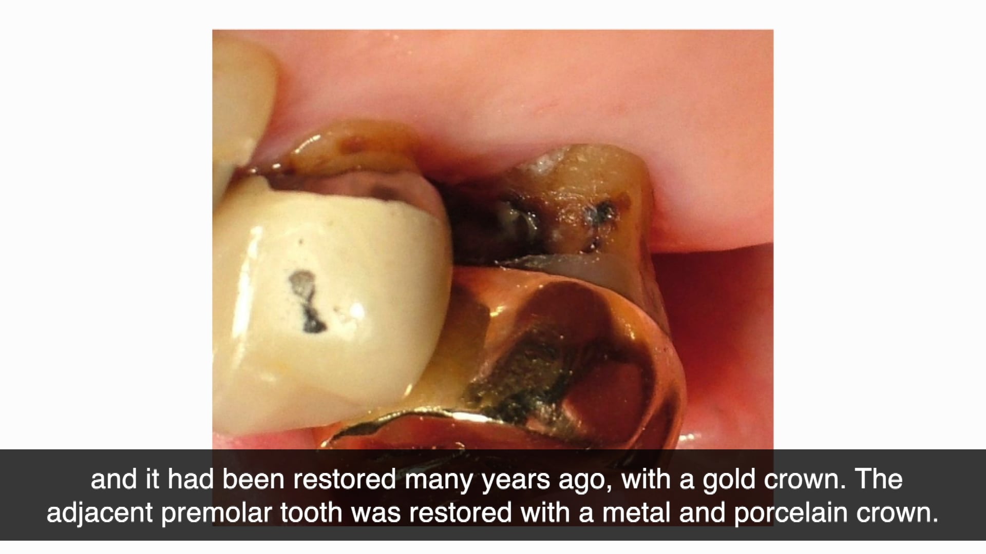 MCM - Dry Mouth Instruction on Vimeo