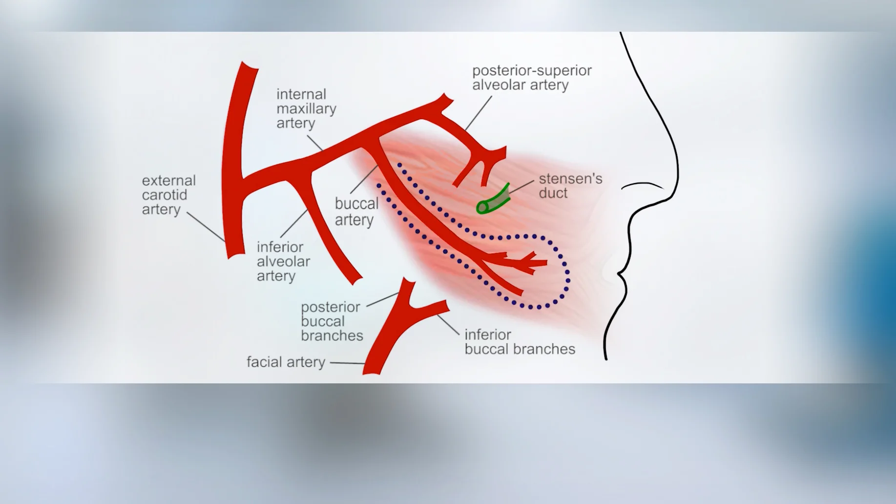 Buccal Myomucosal Flap