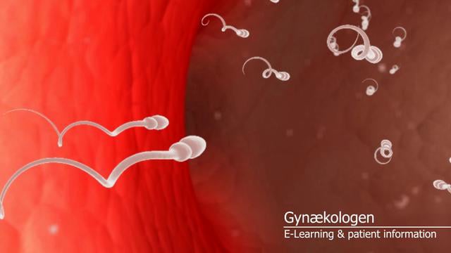 3D animation of fertilization for E-Learning and patient information ...