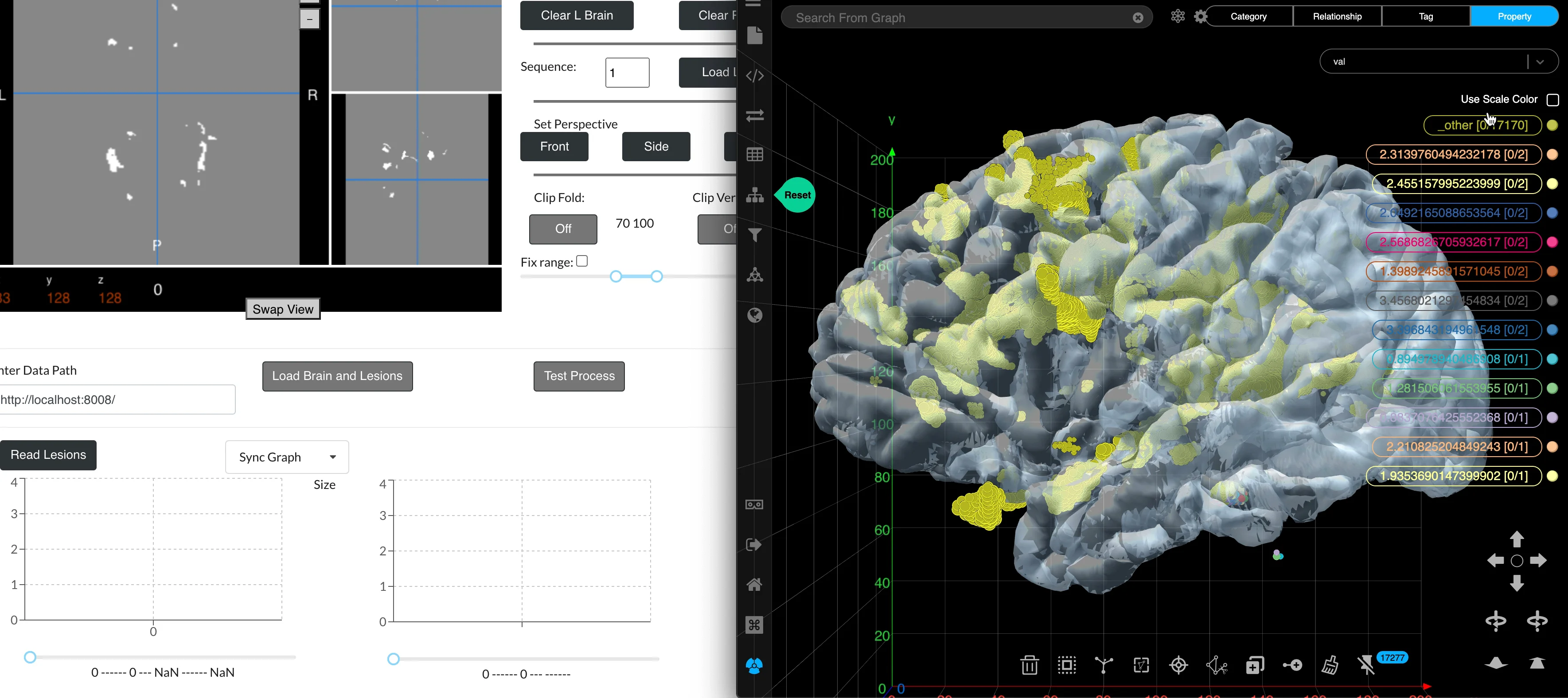 Brain_Viz_filter_size_val on Vimeo