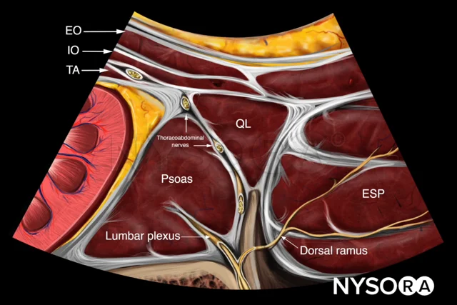 Quadratus Lumborum Muscle Cross Section
