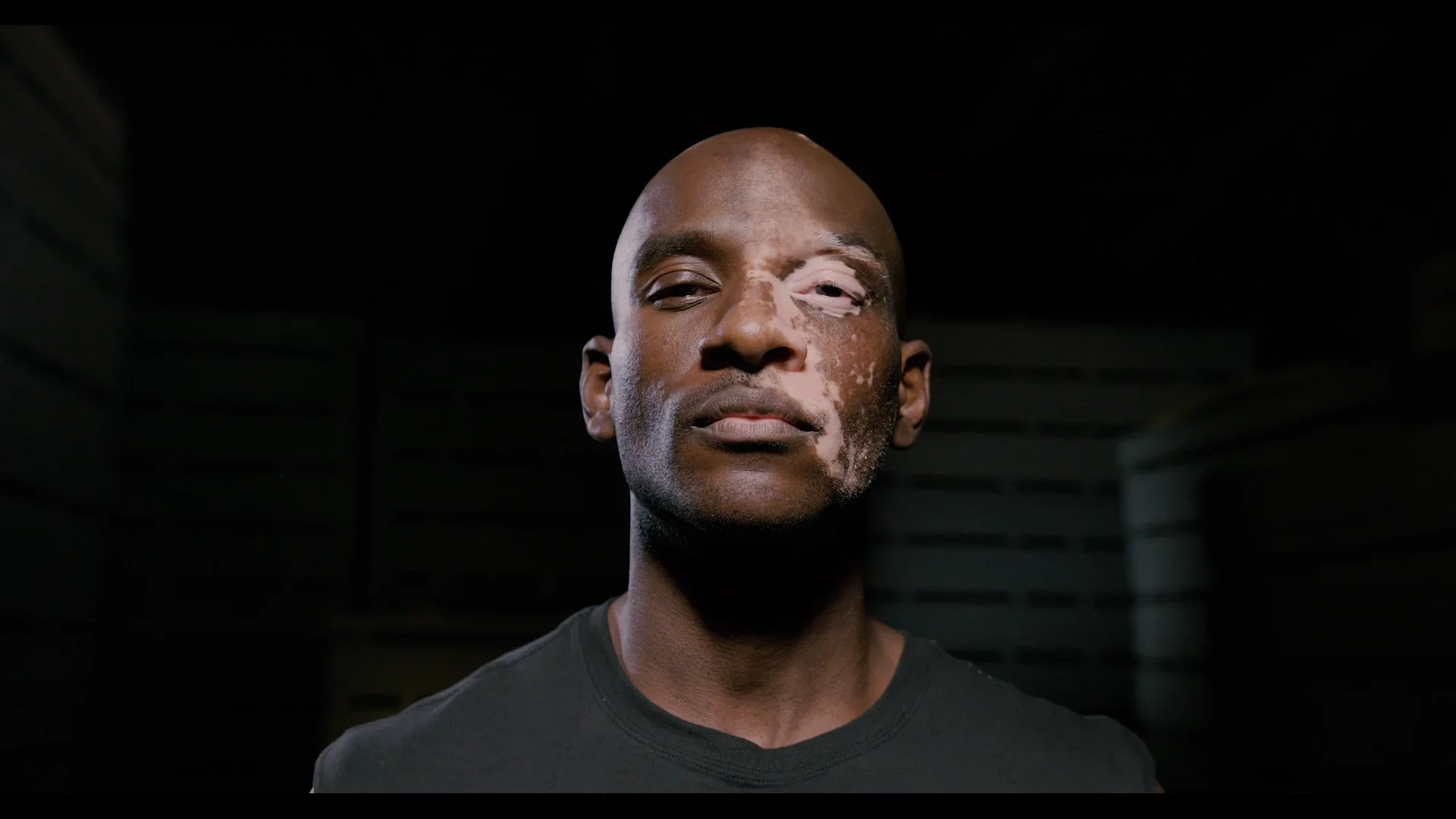 James Mcleod - That Vitiligo Guy on Vimeo