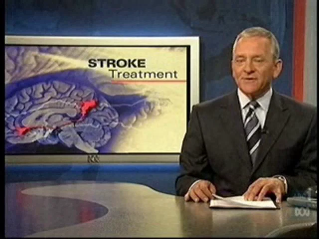 Acute stroke treatment by clot retrieval on Vimeo
