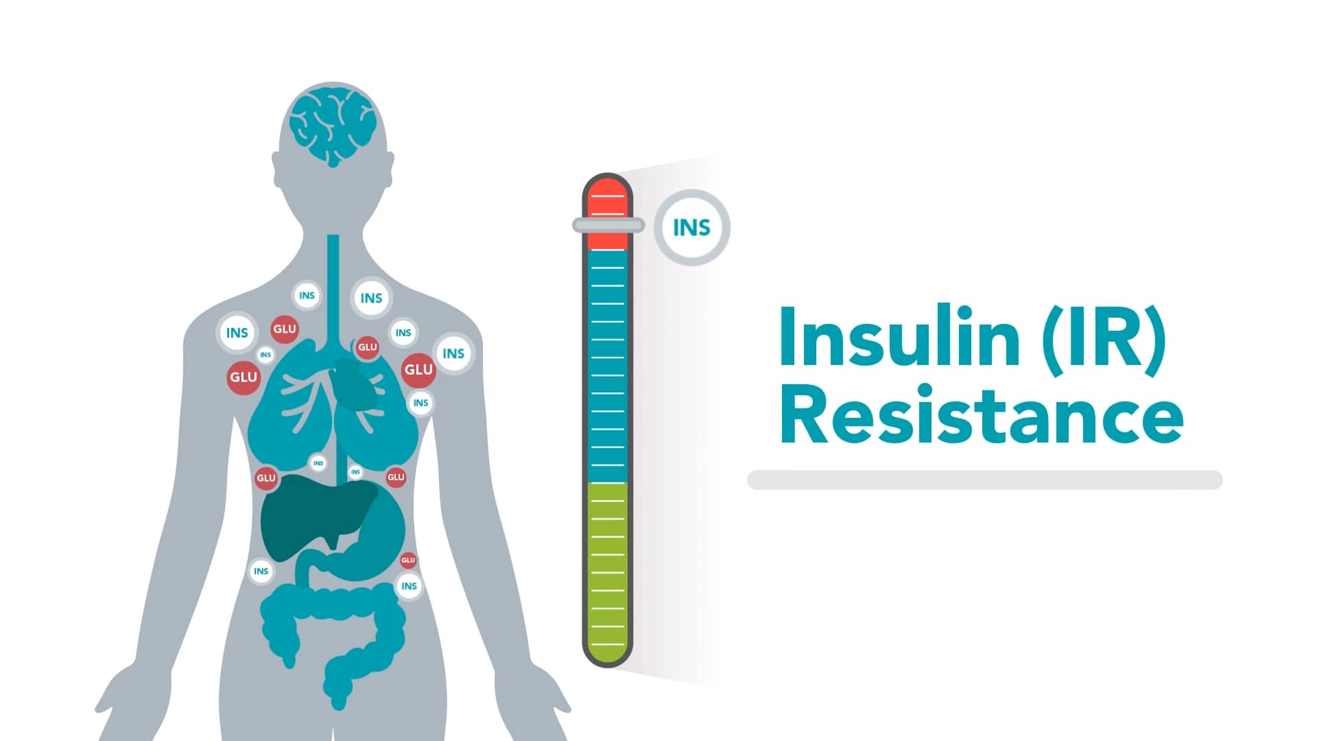 Understanding Insulin Resistance on Vimeo