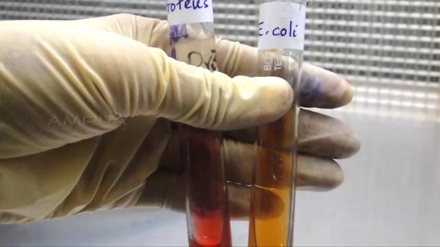 Urease Test - Amrita University on Vimeo