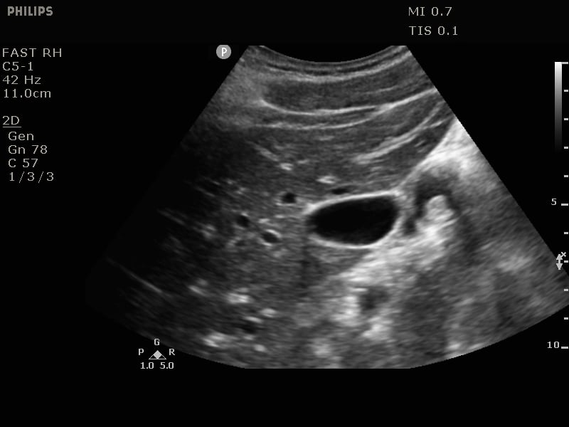 GB - Video 6 - Gallbladder Short Axis on Vimeo