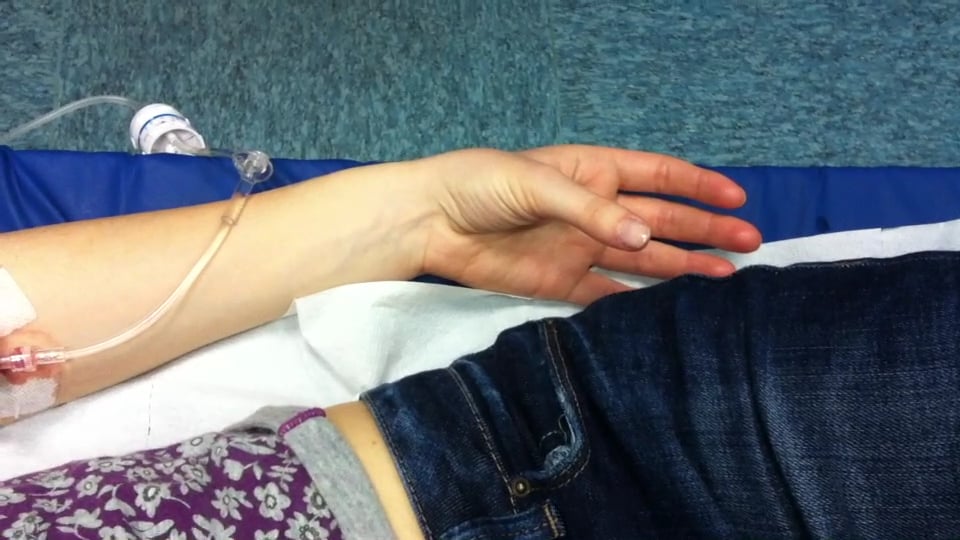 The dystonic reaction from subtle onset to the full-blown presentation ...