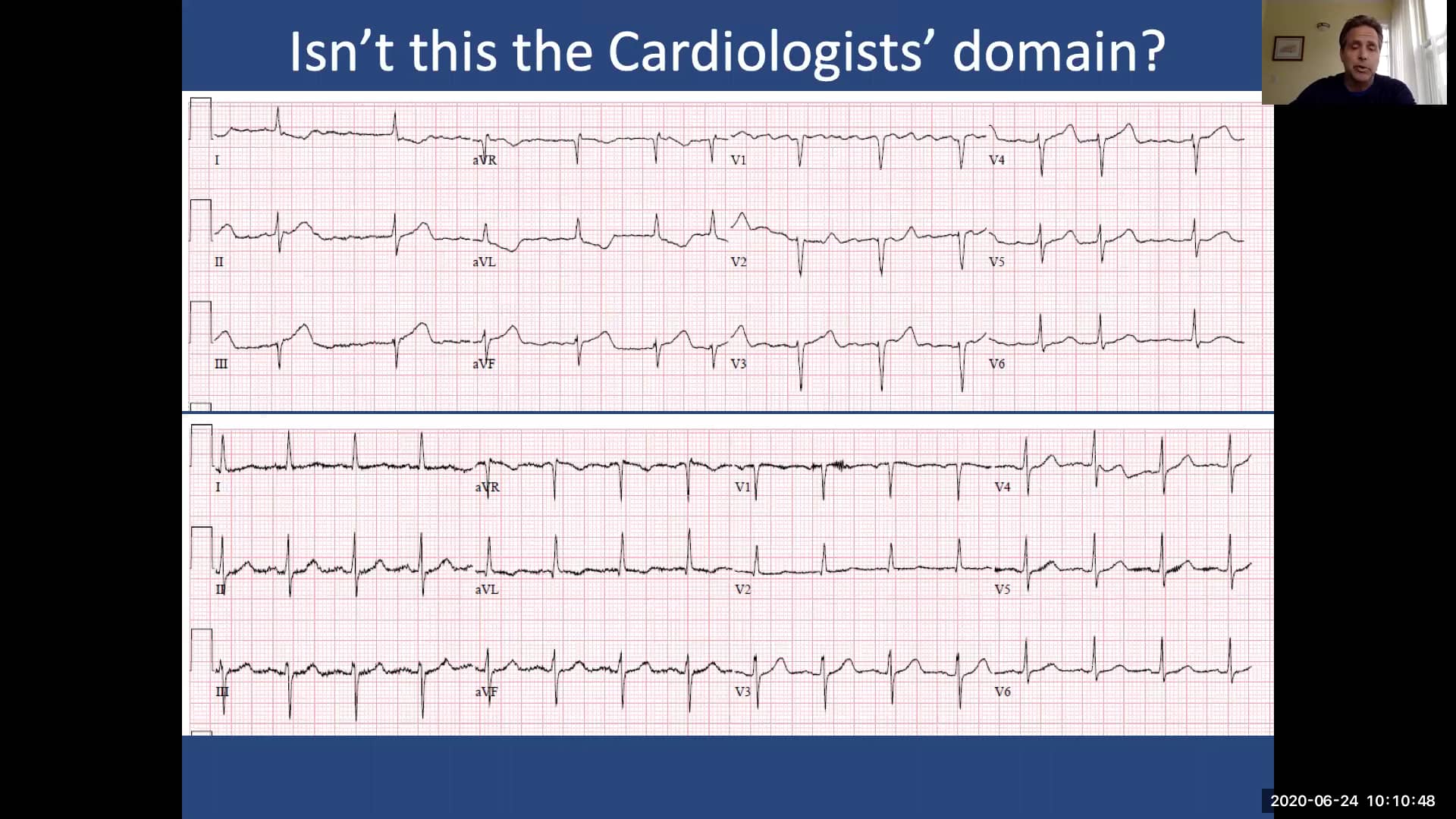 The False STEMI-NonSTEMI Dichotomy - Steve Smith on Vimeo