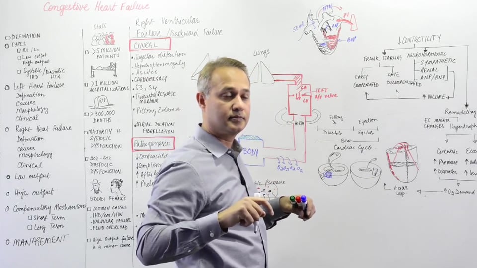 Right Heart Failure: is it backward or forward failure? | DrBeen